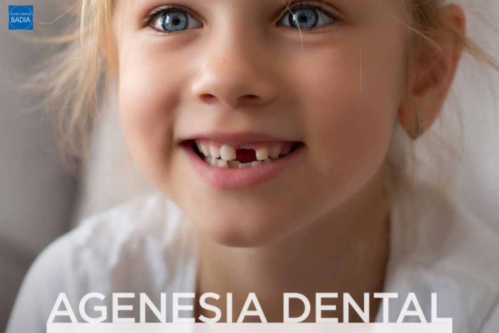 Agenesia dental - Clínica dental Badia